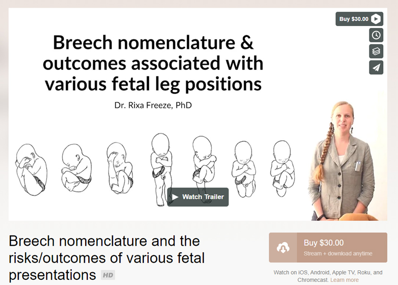 Statistics, risks, and benefits of breech birth